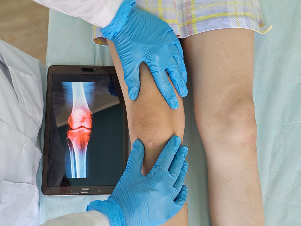 Meniscectomy vs Meniscus Repair | Quantum Ortho